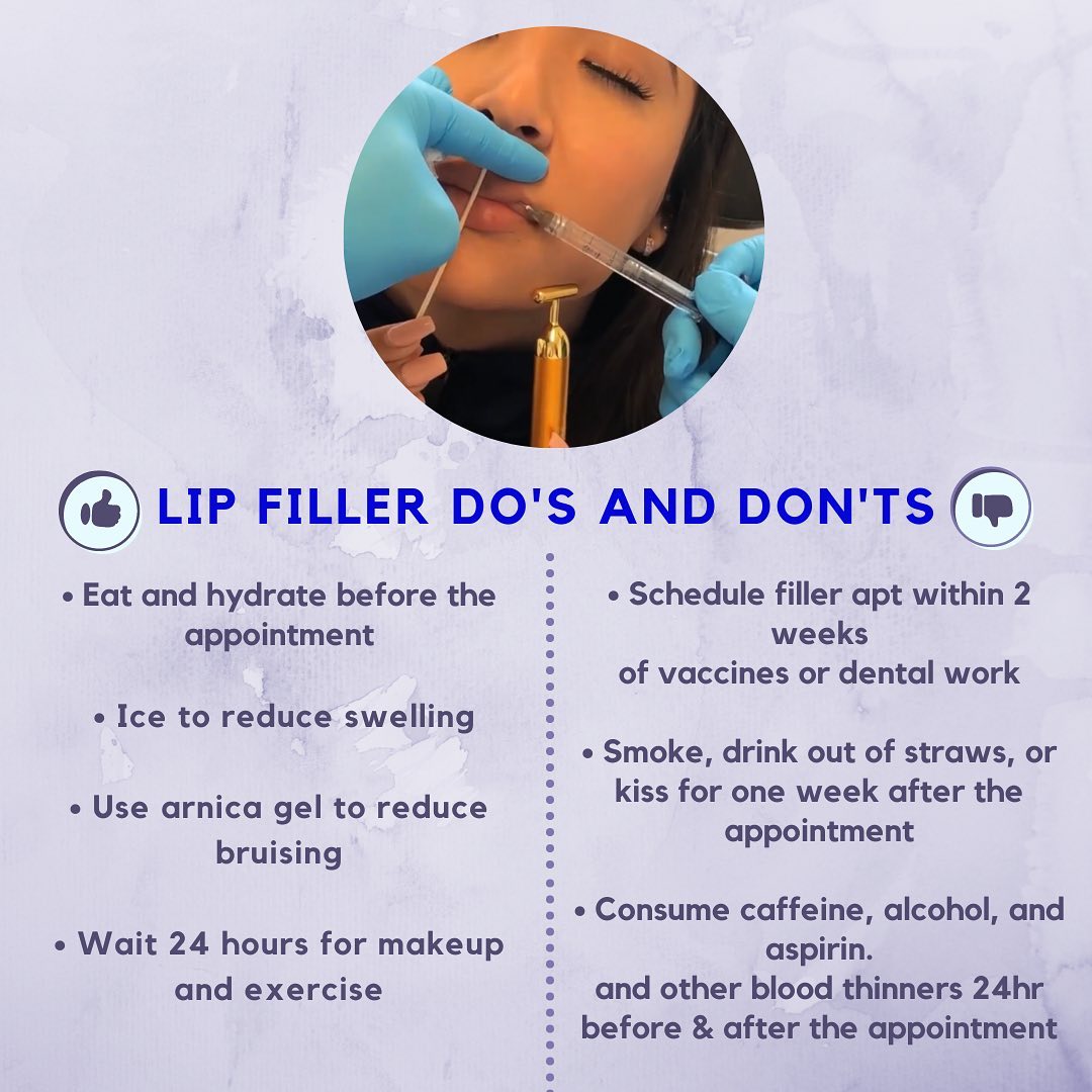 Essential Do's and Don'ts for Optimal Lip Filler Results – Roy Kim, MD