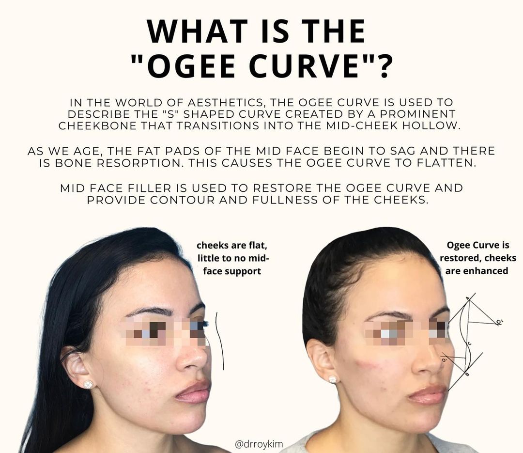 The Ogee Curve: Defining Beauty in Facial Aesthetics – Roy Kim, MD