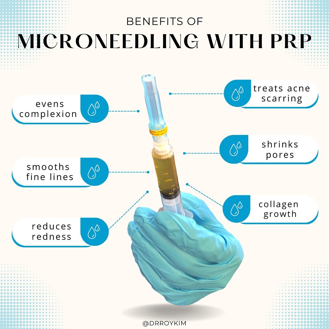 The Power of PRP (Platelet Rich Plasma) in Aesthetic Treatments
